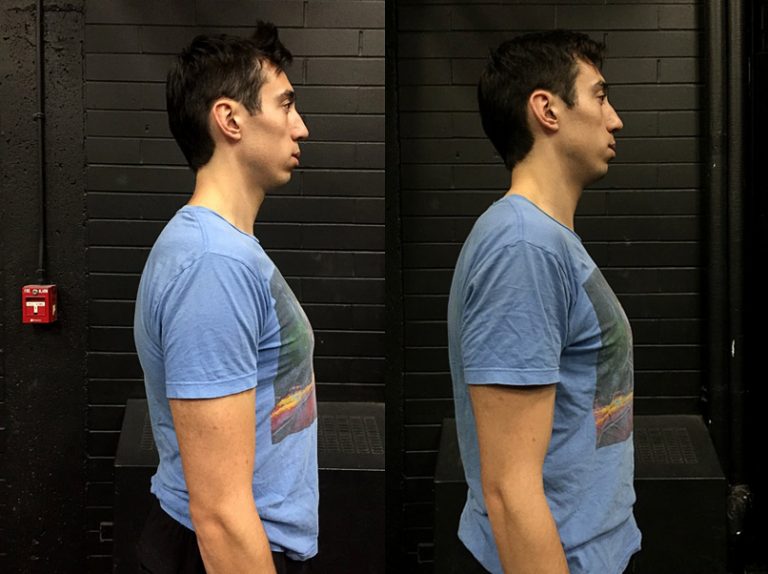 The Skinny Guy's Guide to Fixing Bad Posture