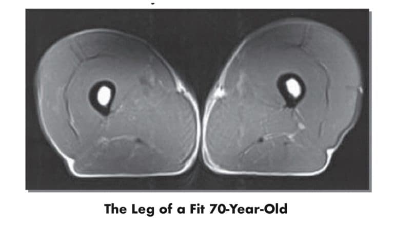How Age Affects Muscle Growth