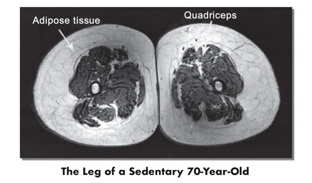 How Age Affects Muscle Growth