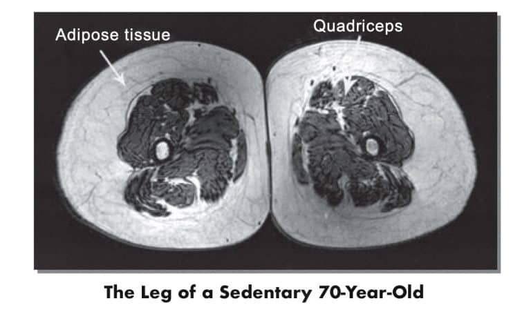 How Age Affects Muscle Growth